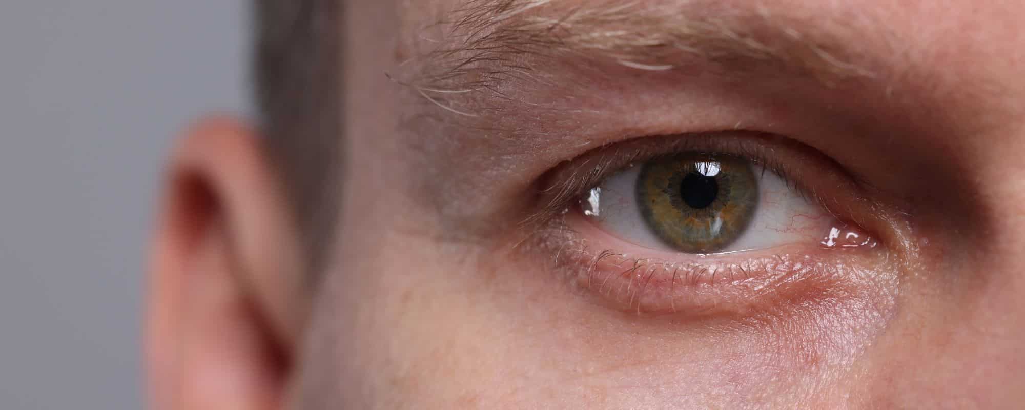 Dilated Pupils and Drugs: What Does It Mean? | Rehab Center